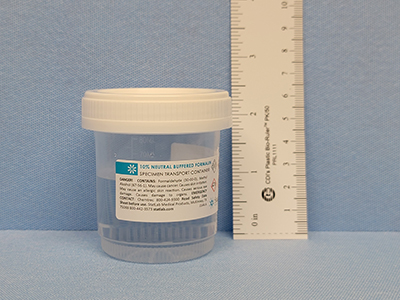 Supply Order Form | Preferred Anatomic Pathology Services